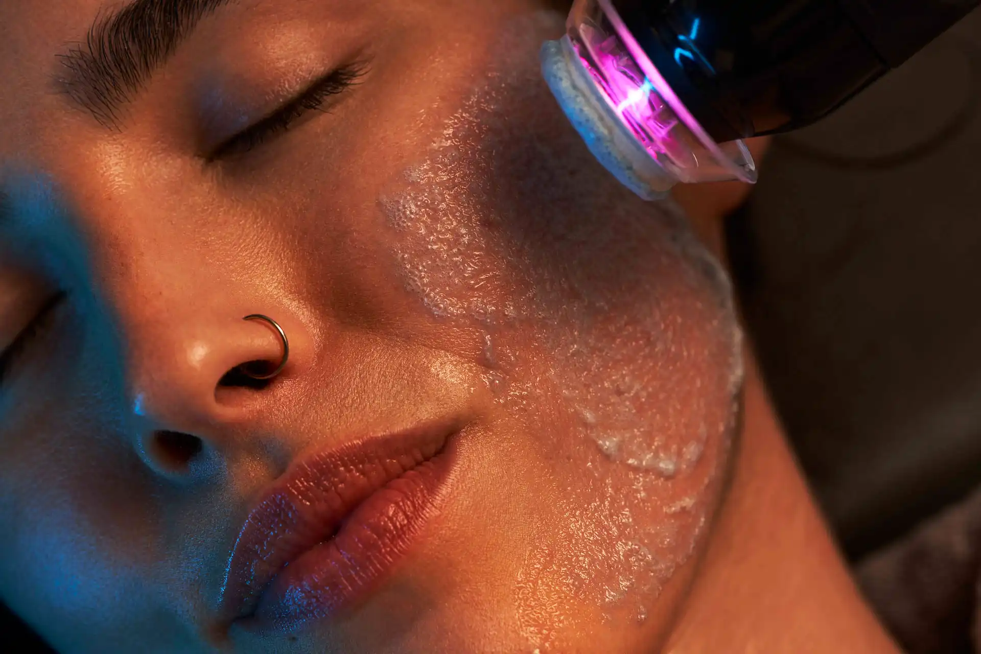 What is Glo2 Facial - A Beauty Laser and Skin